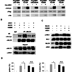 Identification of the acetylation site in long MLCK.