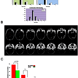SVID grading methods, brain metastases identification, and metastatic ...