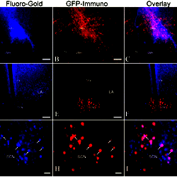 Fluoro-Gold retrograde tracing.