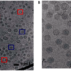 Representative images of virus samples containing empty and full PC ...