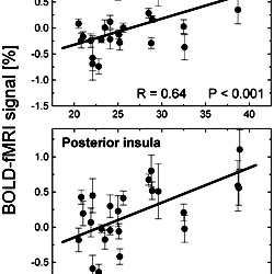 BOLD signals in hyper-activated regions vs. BMI.