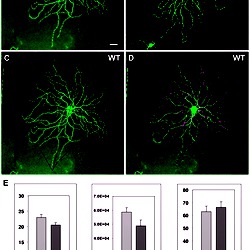 Dendritic arborization of retinal ganglion cells in wild-type and Sez-6 ...