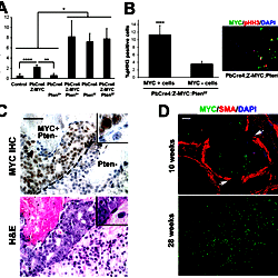 c-MYC expression increases the proliferation and tumorigenicity of Pten ...