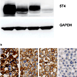 Expression of 5T4 in characterized cell lines.