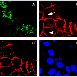 Immunofluorescence staining of HaCaT cells for CCHCR1 and EGFR.