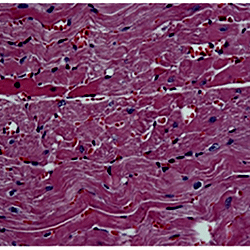 Representative histologic pictures of the heart sections.