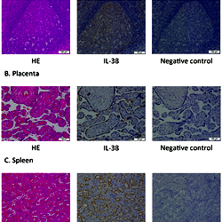Representative images of (left panel) HE staining, (middle panel) IL-38 ...
