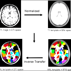 Schematic representation of the transformation of the AAL template into ...