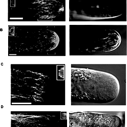 Maximal projections of confocal sections in moss and lily.