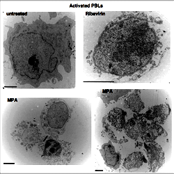 IMPDH inhibition leads to a necrotic morphology.