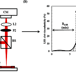 Laser speckle rheology (LSR) instrument and coagulation parameters.