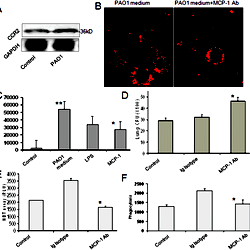 MCP-1 receptor was increased along the enhanced immune function and MCP ...