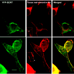 Vimentin-SERT co-localization and impact of 5HT-stimulation on their ...