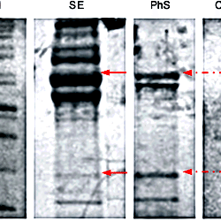 SDS-PAGE electrophorograms of native H. pylori J99 urease partially ...