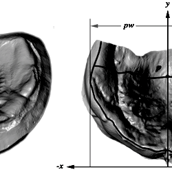 Measurements obtained from digitized plaster casts.