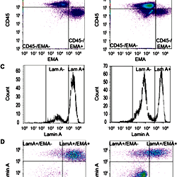 Flow cytometry analysis of lamin A and EMA in adenocarcinoma cells.