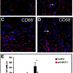 Immnunohistochemical analysis of mouse cardiac allograft treated anti ...