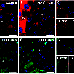 In the exocrine pancreas PEX3 and PEX19 are associated with peroxisomes.