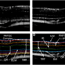 Automated segmentation of mouse OCT volumes (ASiMOV): Validation ...
