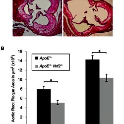 Cross-sectional plaque area at the aortic root.