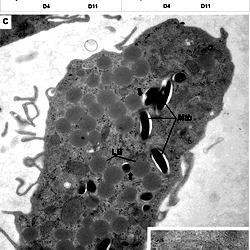 Morphological appearance of foamy macrophages and bacteria within ...