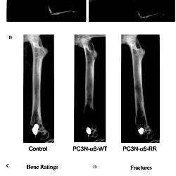 SCID Mouse xenograft model and quantification of bone destruction after ...