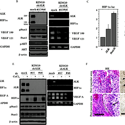 ALK/Stat3/HIF-1α axis in astrocytoma cells.