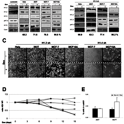 Variant-specific effects of H1 depletion in cell progression are not ...