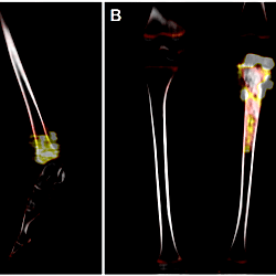 Shape elongation’s measure.