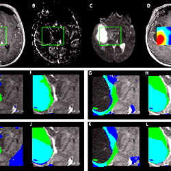 Coregistered set of MRI images.