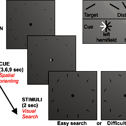 Paradigm separating spatial orienting (SO) and visual search (VS).