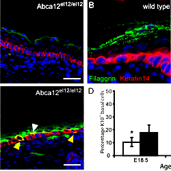 Pathology of the Abca12 mutant epidermis.