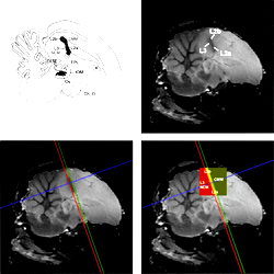 Visualisation of Field L2 on high resolution T2-weighted SE images and ...