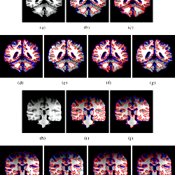 Segmentation results on clinical brain MR images.