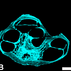 μCT and SLOT images of the identical human cochlea sample.