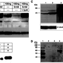 Analysis of MMP-3 and NR1 protein expression and digestion in cultured ...