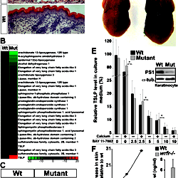 Skin-Barrier Defect Explains How Loss of Notch Signaling in the Skin ...