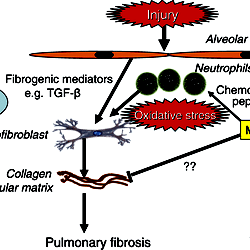 Mechanisms of IPF