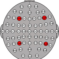 (Color on-line) Setup for EEG channels: 64 electrodes as per the ...