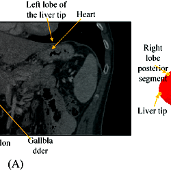 Illustration of mark point selection.