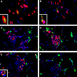 Double staining images after spectral imaging.