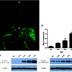 Mac-2 staining illustrating differences monocyte/macrophage ...