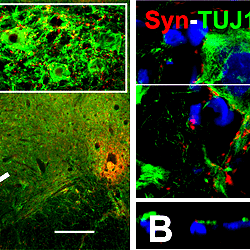 Innervation of Host Motor Neurons by Graft-Derived Nerve Cells as Shown ...