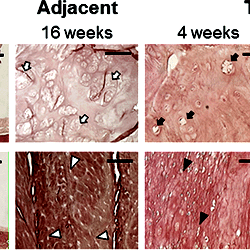 Picrosirius red staining showed an absence of tissue in the ...