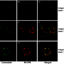 Cellular localization and colocalization pattern of CaM in confocal ...
