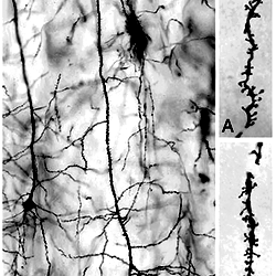 Photomicrograph of a typical layer 3 pyramidal cell in MPC.