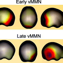 Grand average localization of vMMN generators.