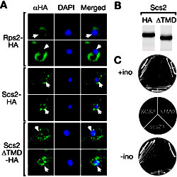 Membrane Association Is Essential for Scs2 Function
