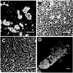 Culture of hES cells.