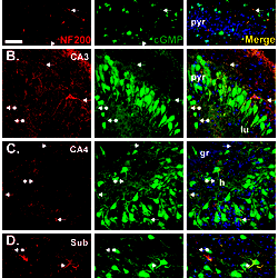 Double labelling for cGMP and the axonal marker, NF200.